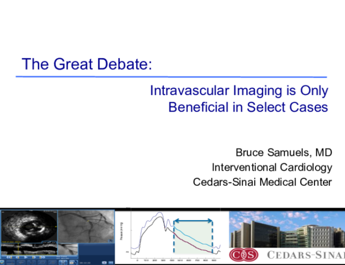The Great Debate: Intravascular Imaging is Only Beneficial in Select Cases | tctmd.com